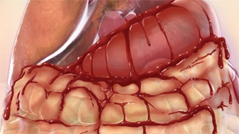 Medical Graphics | MediVisuals + High Impact