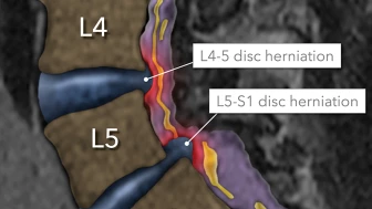 Custom Illustration Agency | MediVisuals + High Impact