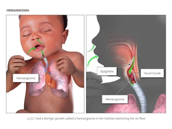 Vocal Cord Anatomy