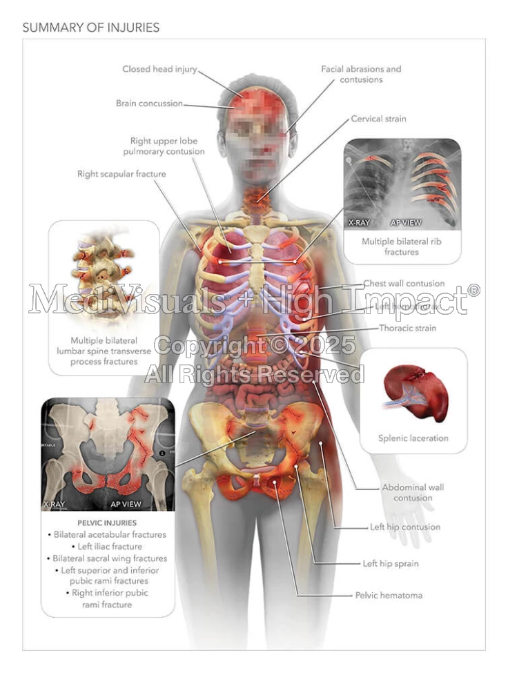 Summary of Injuries | MediVisuals + High Impact
