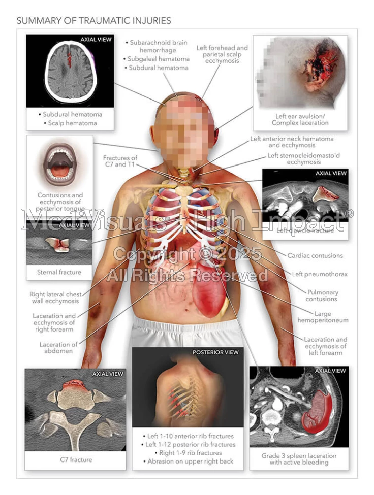Summary of Traumatic Injuries | MediVisuals + High Impact