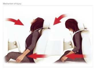 Animated Vehicle Collision Magnifies Pelvic | High Impact