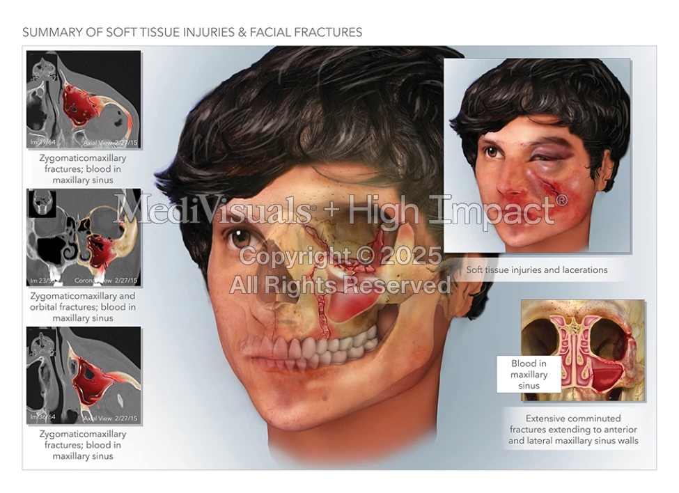 Trial Graphics - Face Injuries | MediVisuals + High Impact