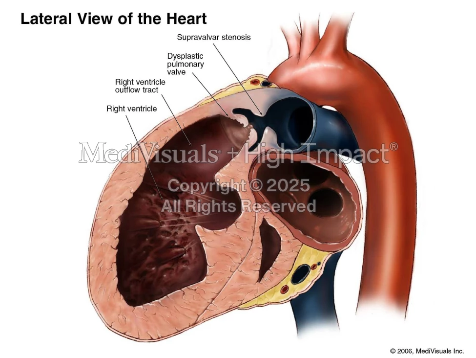 Lateral View of the Heart | MediVisuals + High Impact