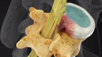 Digital Injury Summary | MediVisuals + High Impact