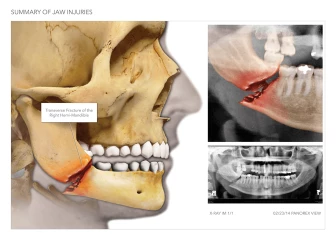 Anatomy of the Jaw and Teeth | MediVisuals + High Impact