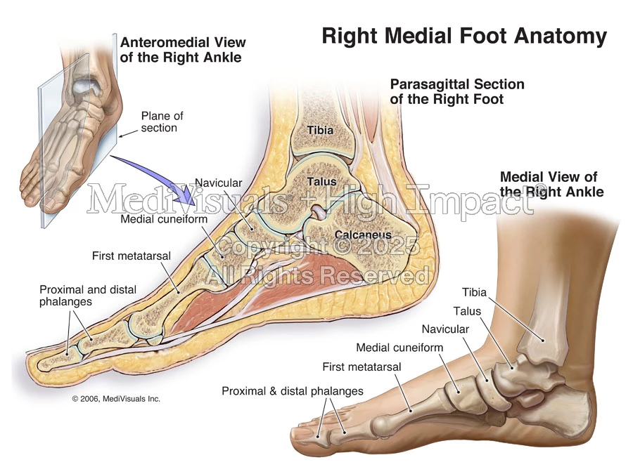 Right Medial Foot Anatomy | MediVisuals + High Impact