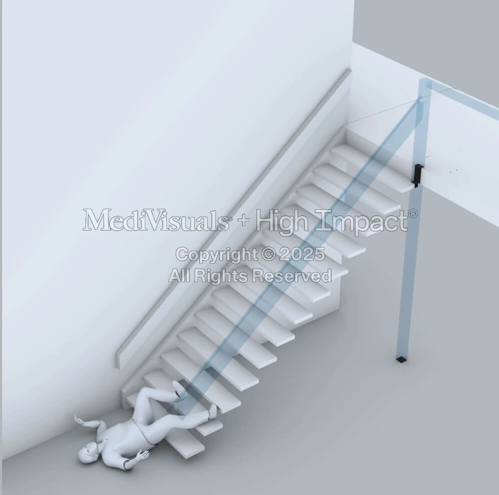 Trial Graphics - Slip and Fall | MediVisuals + High Impact