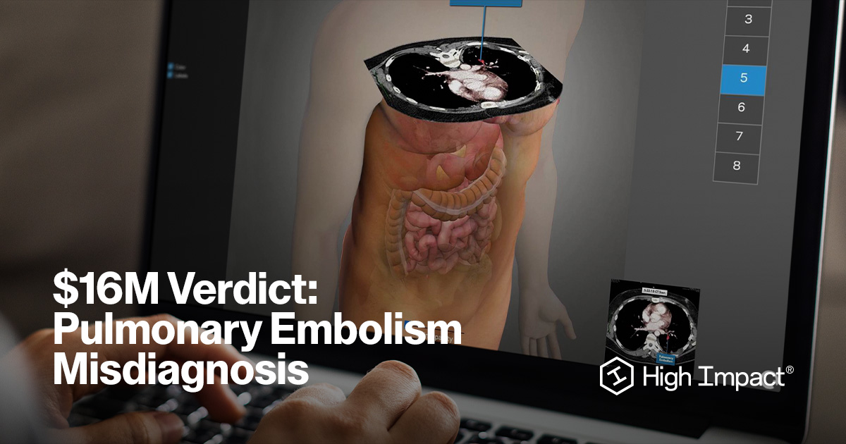 Legal Exhibits Demonstrate Misdiagnosis of Pulmonary Embolism ...