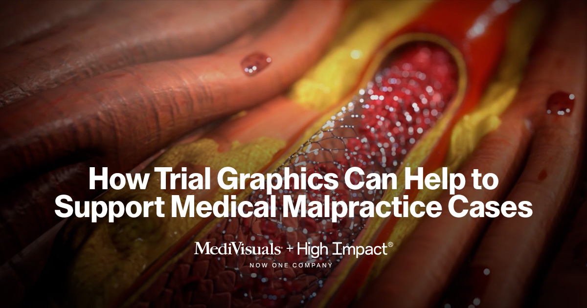 Using Trial Graphics for Medical Malpractice Cases | MediVisuals + High ...
